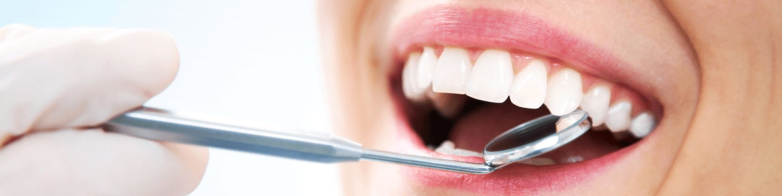 Zahnstein - Entstehung, Vorbeugung und Entfernung - MAXCARE