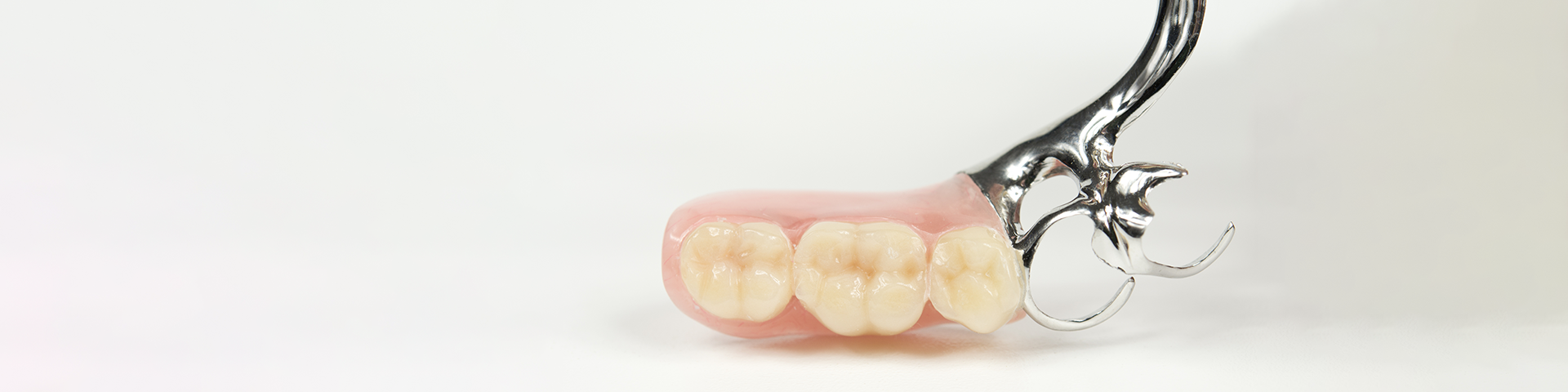 Klammerprothese - Günstig und gut oder keine optimale Lösung? - MAXCARE