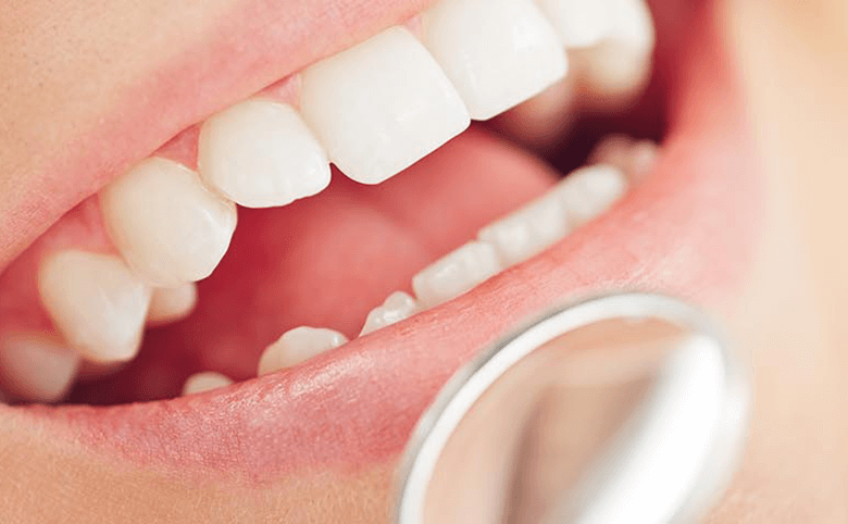 Gesunde Zähne durch Zahnaufbau: Welche Möglichkeiten gibt es? - MAXCARE